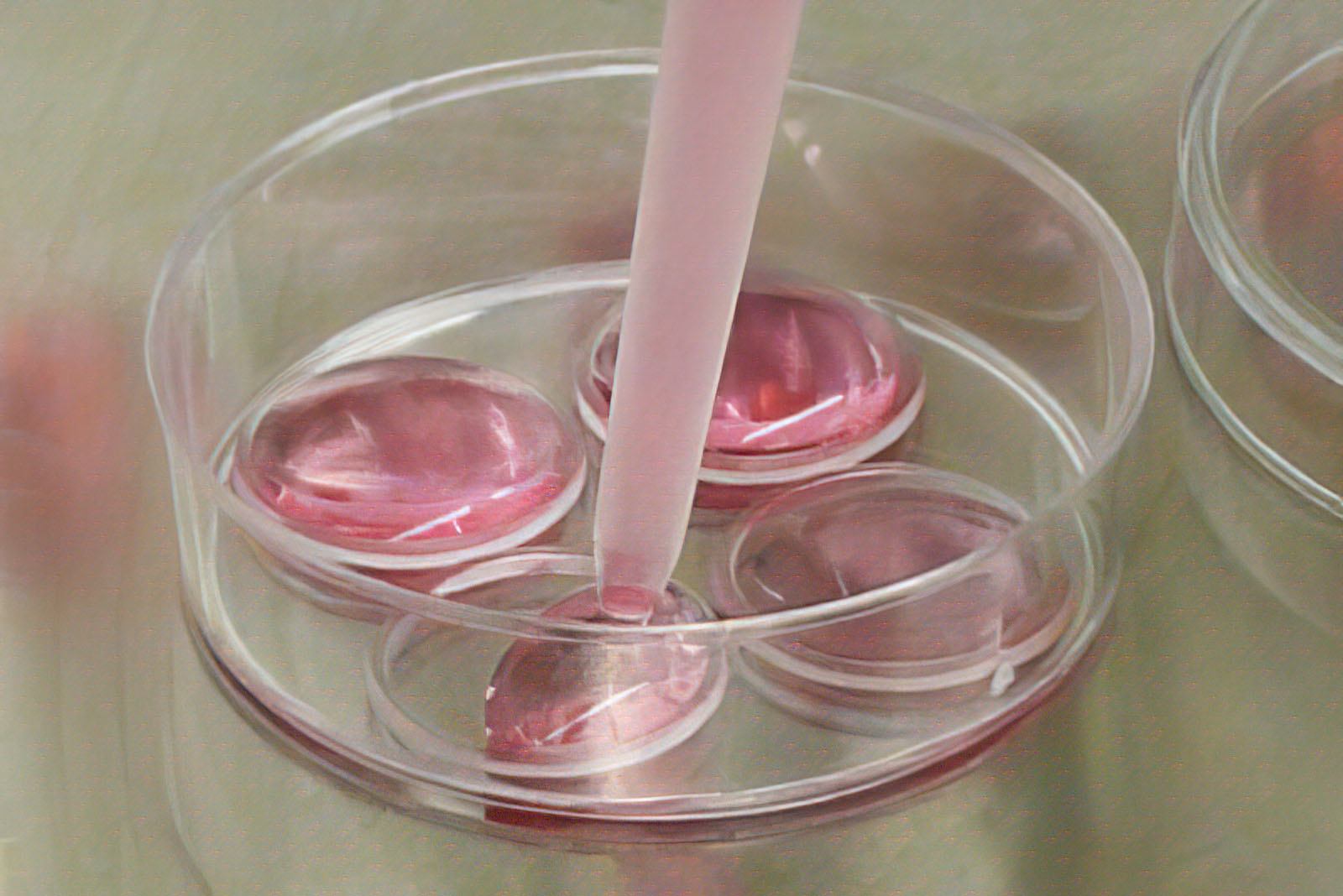 Preferred Cell Systems -- Culture Media for the Life Sciences